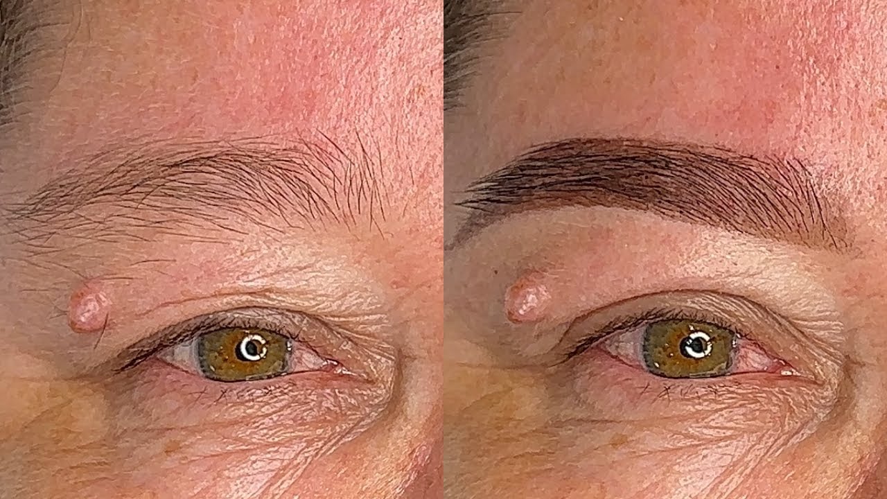 Epic Brow Transformation! - YouTube