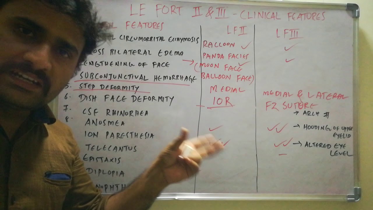 Le fort II & III - Clinical features comparison - YouTube