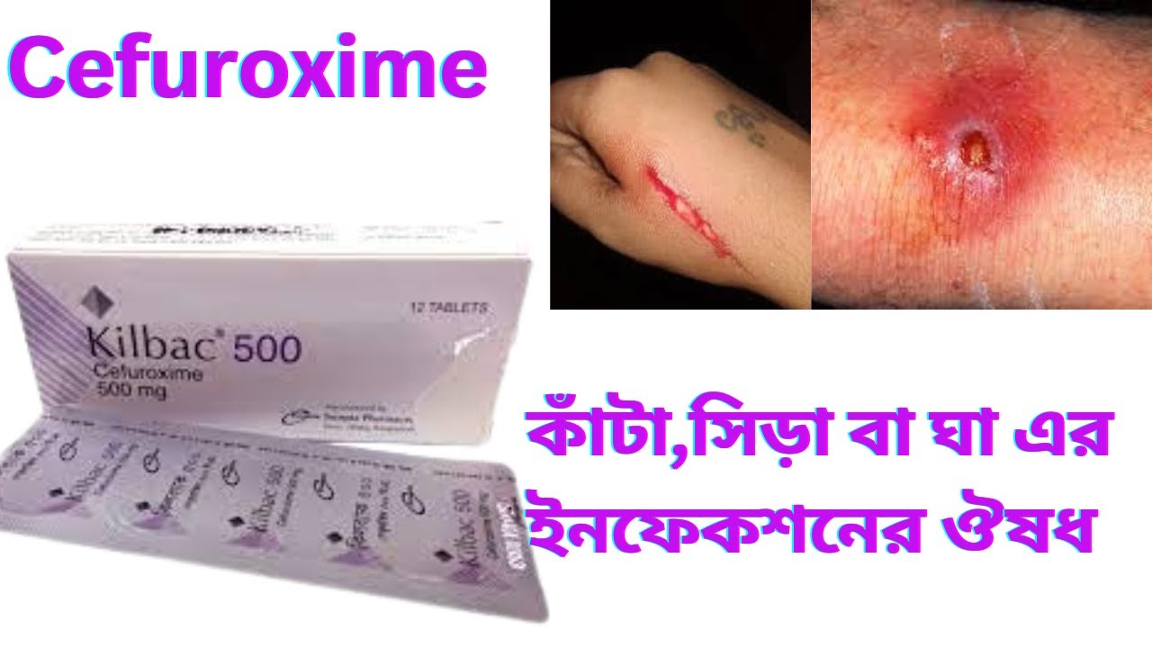 Kilbac tablet || Cefuroxime || কাঁটা,সিড়া বা ঘা এর ইনফেকশনের ঔষধ ...