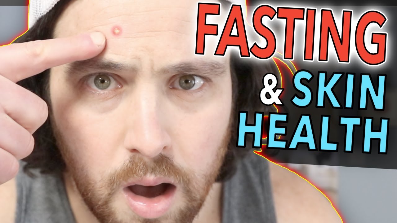 Intermittent Fasting Skin Benefits | Can it Clear Up Your SKIN? - YouTube