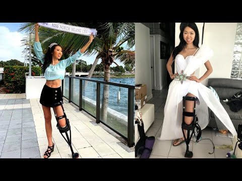 Injured Miss Florida Contestant Uses ‘Pirate Leg’ at Pageant