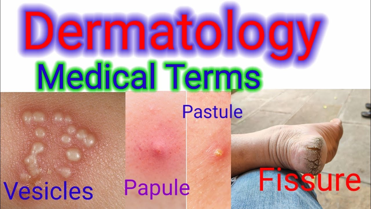 Dermatology Lesions terminology || Dermatology Terms || Terms with ...