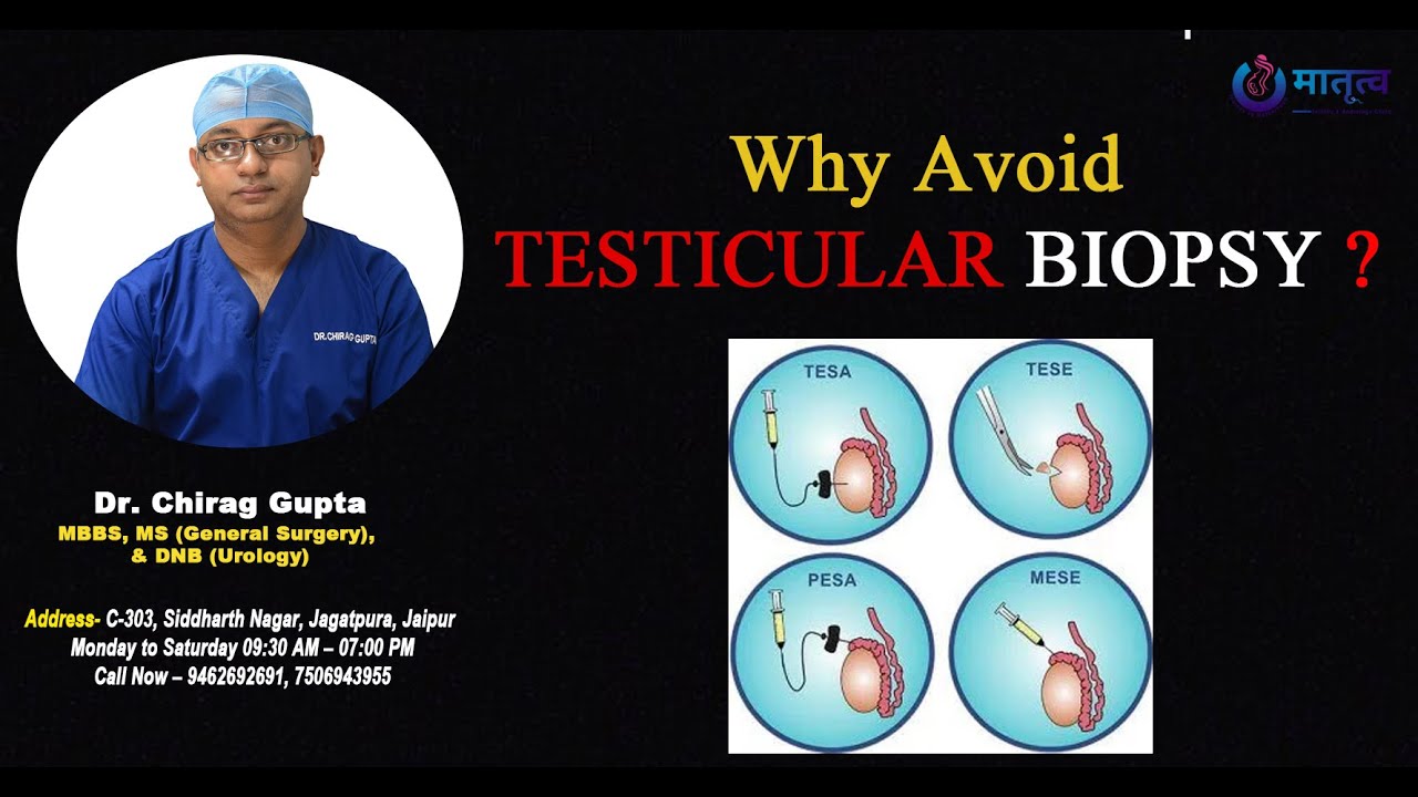 TESTICULAR BIOPSY IN AZOOSPERMIA | WHY AVOID TESTICULAR BIOPSY ? - YouTube