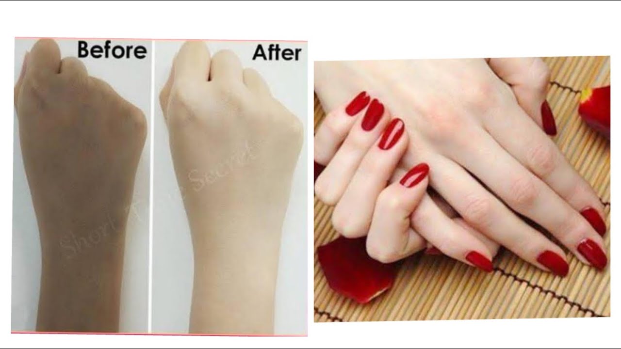 Hand whitening and sun tan removal#remedy#tanning#pigmentation#home# ...