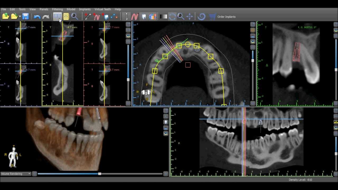 Blue Sky Plan 3 Tutorial: Tangential View - YouTube