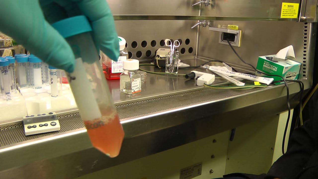 Ack Lysis Buffer Recipe - Banana-breads.com