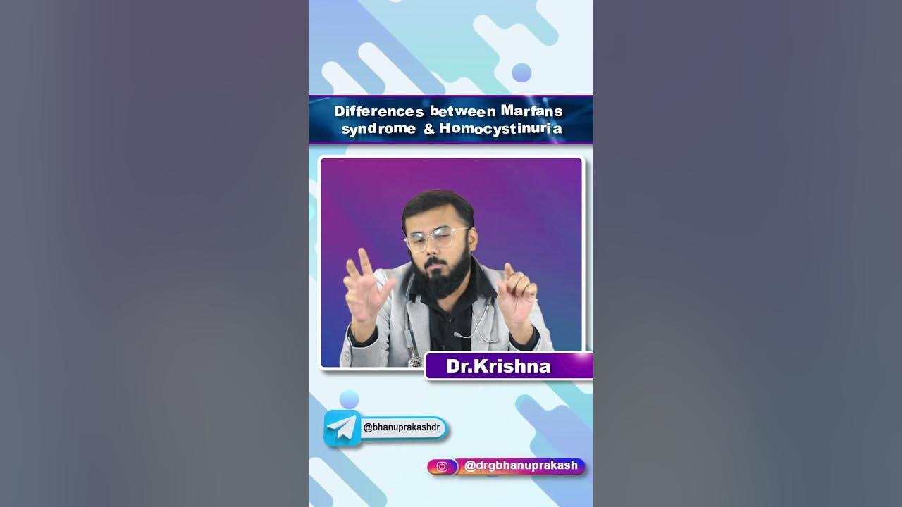 Differences Between Marfans Syndrome And Homocystinuria Youtube