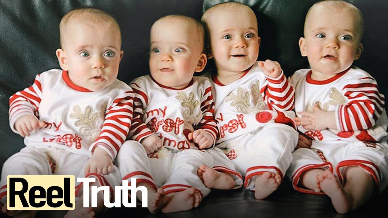 Identical Monochorionic Quadruplets (Extraordinary People) | Medical ...