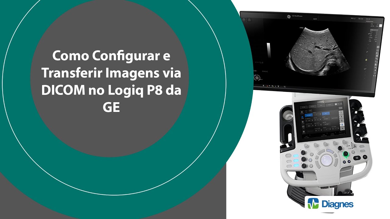 Como configurar e transferir as imagens do ultrassom Logiq P8 da GE ...