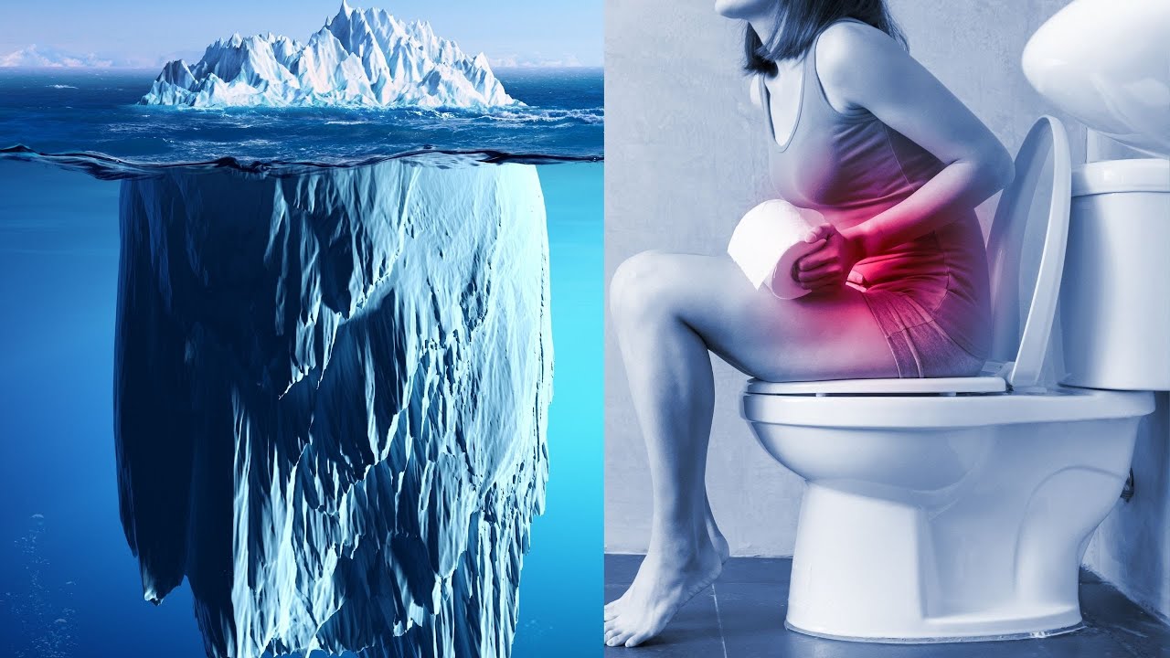 MITOS & VERDADES SOBRE A FORMAÇÃO DO BOLO FECAL! Live com Nutricionista ...