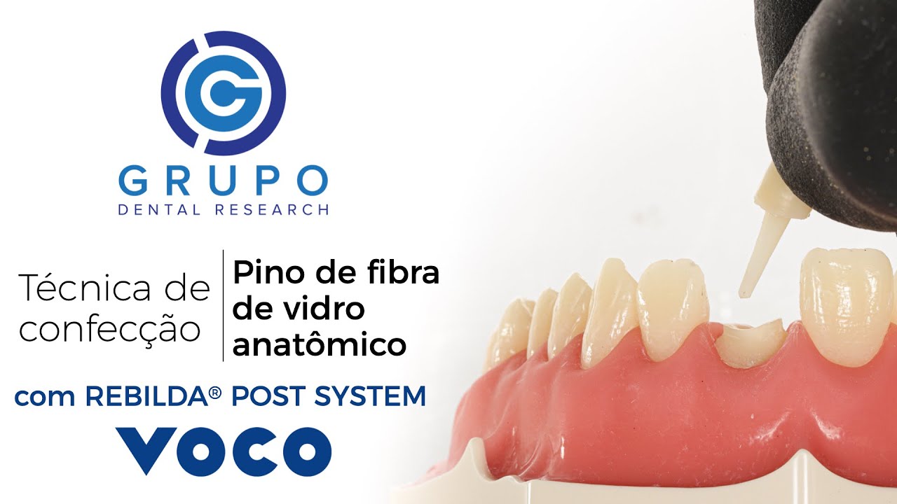 REBILDA POST System - Preparo e Cimentação de Pino anatômico de Fibra ...