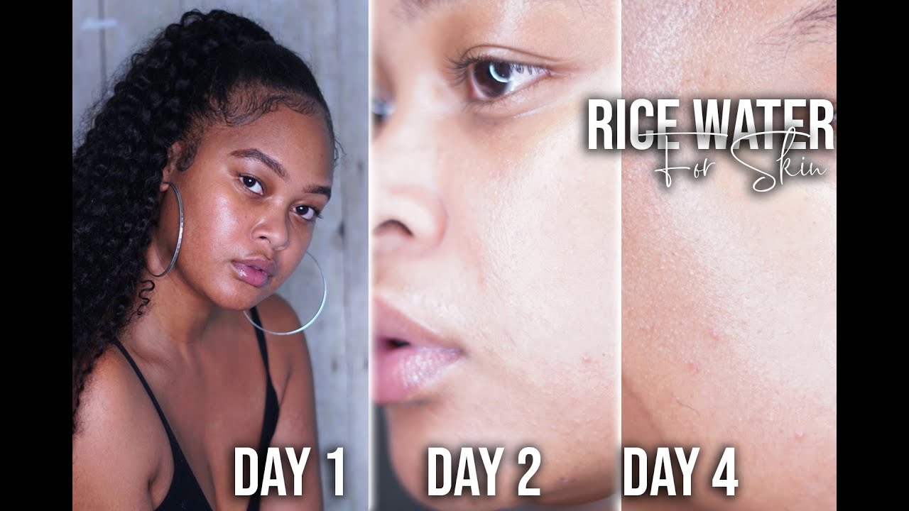 THIS IS WHAT 4 DAYS OF RICE WATER ON MY FACE LOOKS LIKE! - YouTube