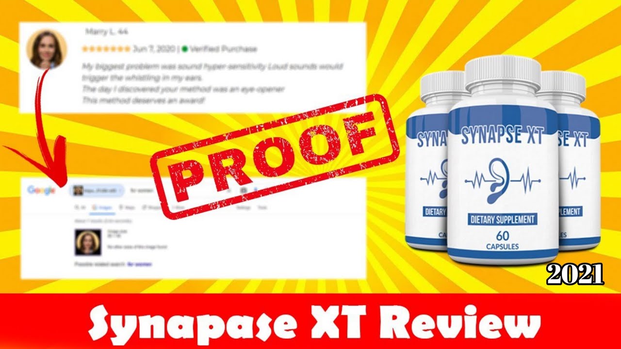Synapse xt reviews consumer reports 2021 - YouTube