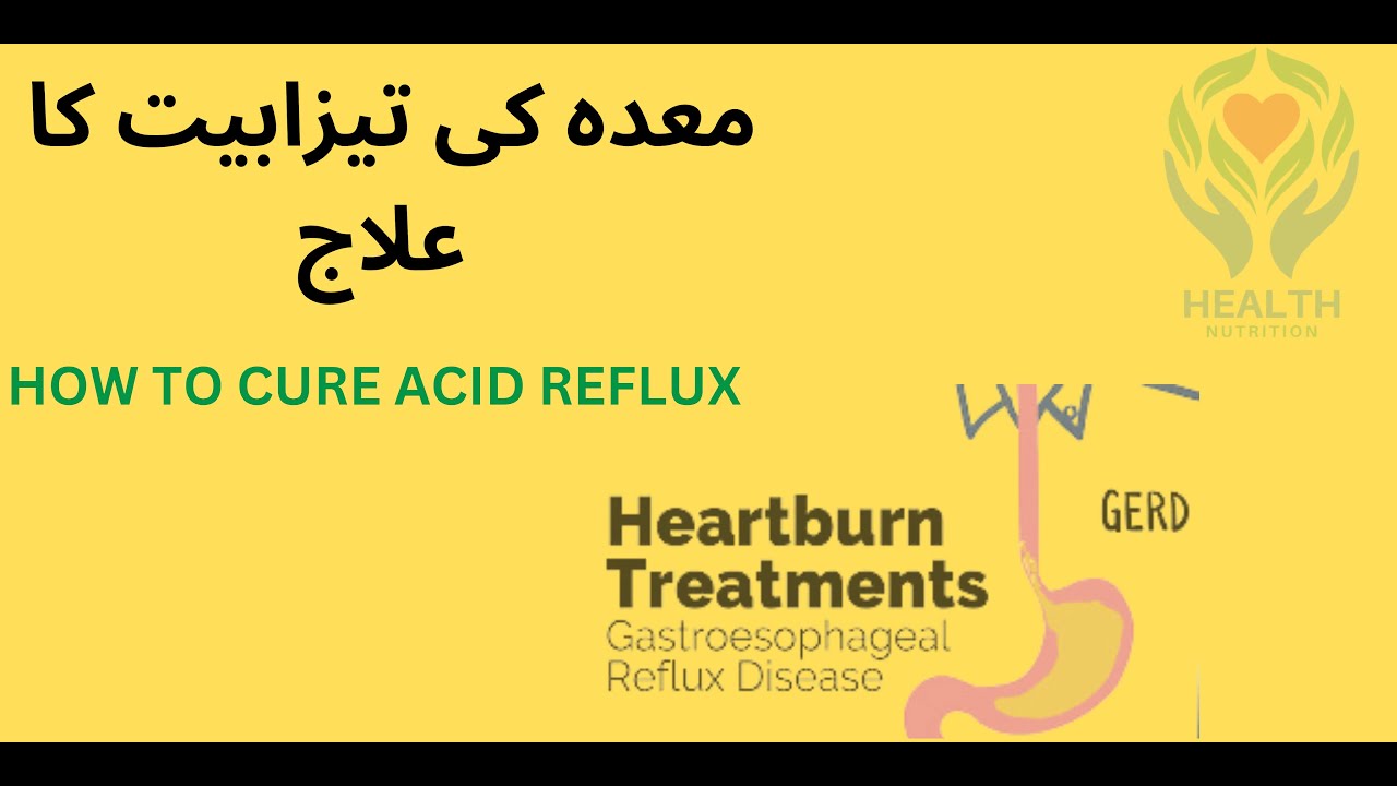 How To Cure Acid Reflux | GERD Heartburn Remedies | Maiday ki Tezabiat ...