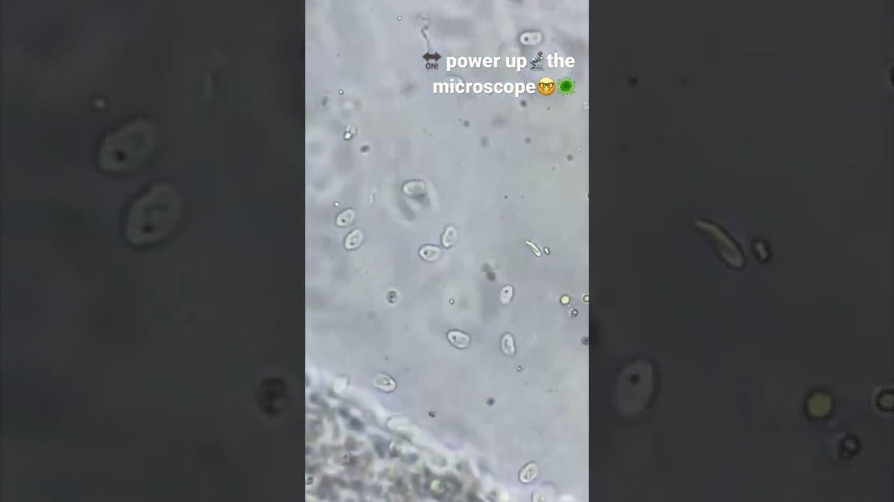 Ichthyobodo Necátor parasite #Shorts #MicroscopyShorts - YouTube
