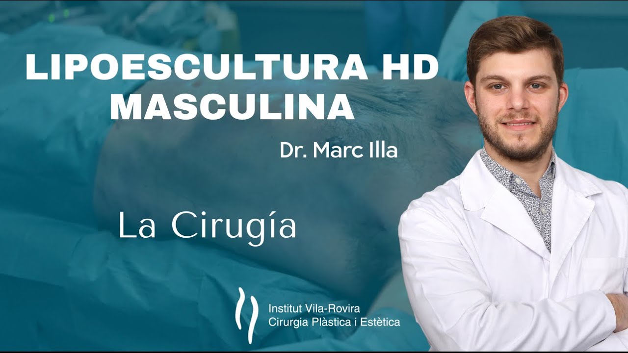LIPO ESCULTURA HD COMPLETA LA CIRUGÍA - YouTube
