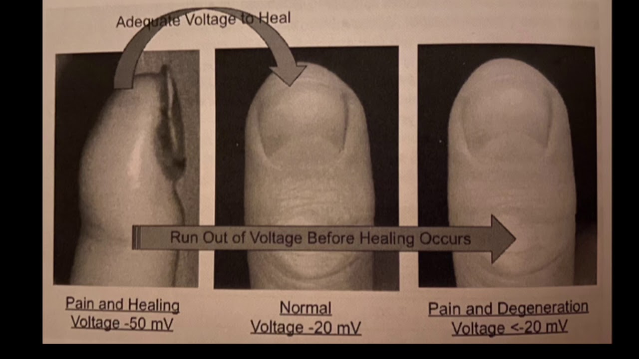 Healing Is Voltage - Chapter 3 Pages 56-72 by Jerry Tennant, MD - YouTube