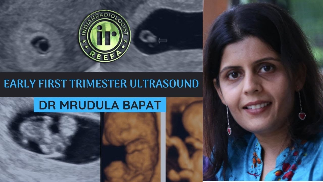 EARLY FIRST TRIMESTER ULTRASOUND | DR MRUDULA BAPAT | - YouTube