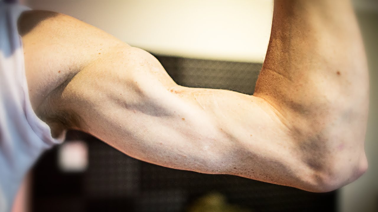 What happened to his arm... - YouTube