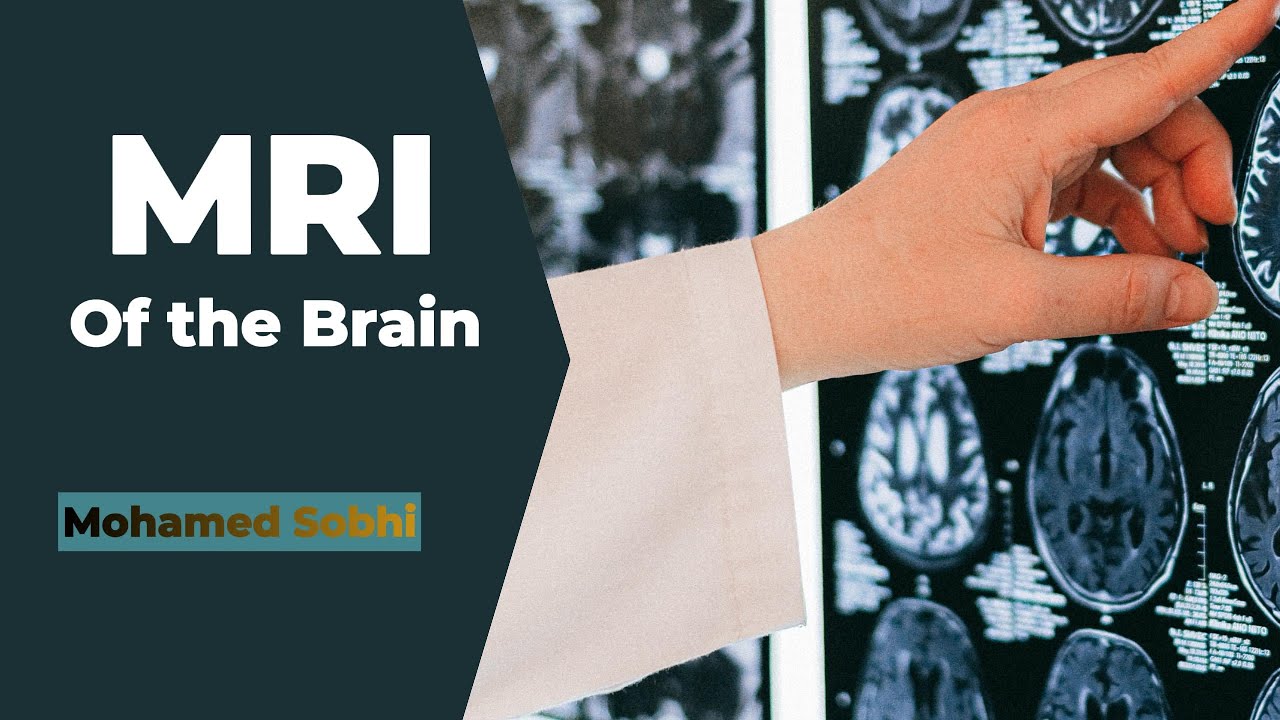 "Brain MRI Simplified: Anatomy & Key Sequences Explained" - YouTube