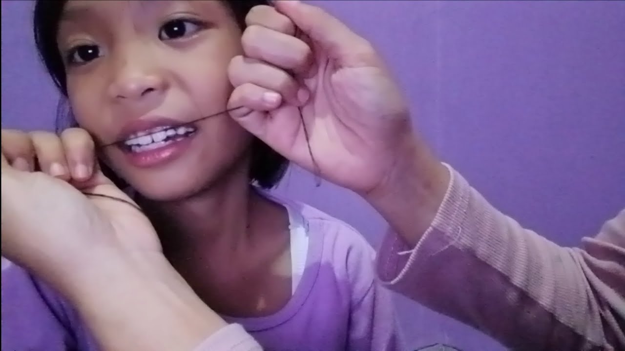 Cabut Gigi pakai Benang Part 1 - YouTube
