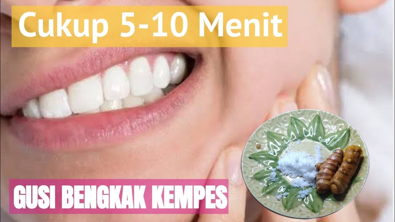 10 Menit Gusi Bengkak Sembuh - Obat Gusi Gusi Bengkak Karena Gigi ...