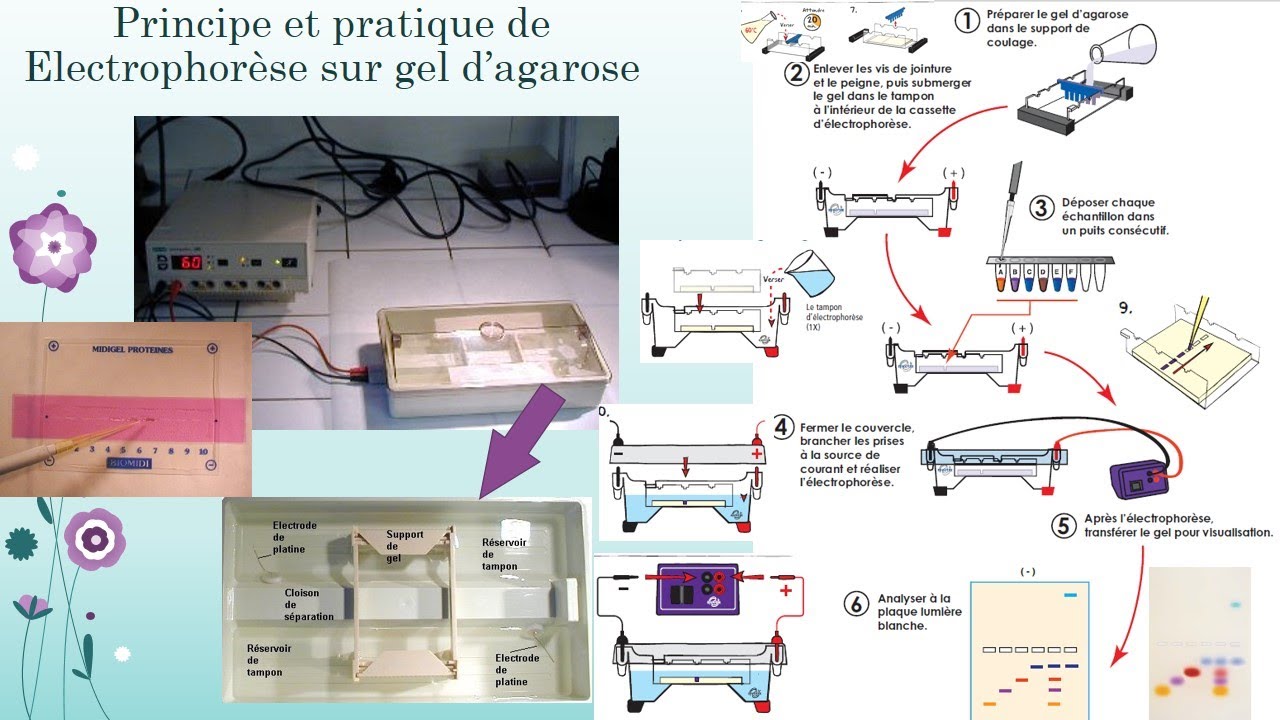 EPP sur gel et électrophorèse capillaire (Exploration-dysprotéinémies ...
