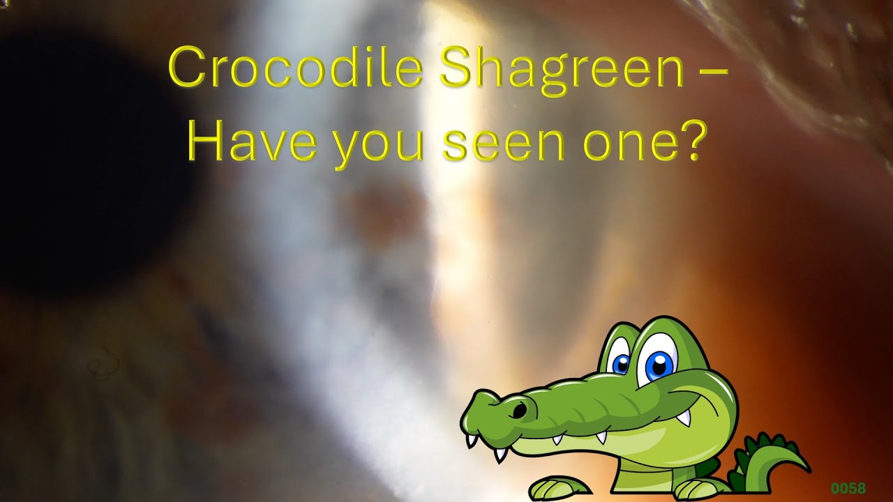 0058: Crocodile Shagreen - Have you seen it? - YouTube