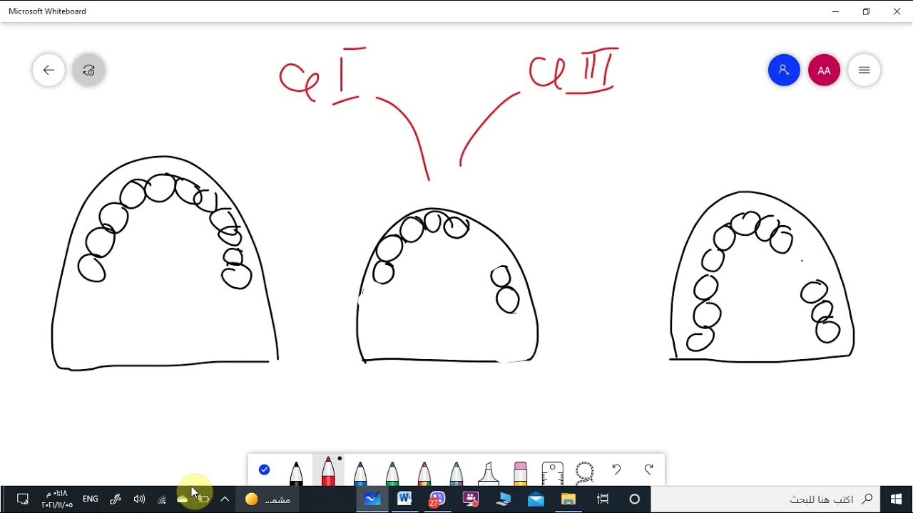 Is it Class III, Mod 2 or Class I, Mod 1 Applegate Vs Hussein - YouTube
