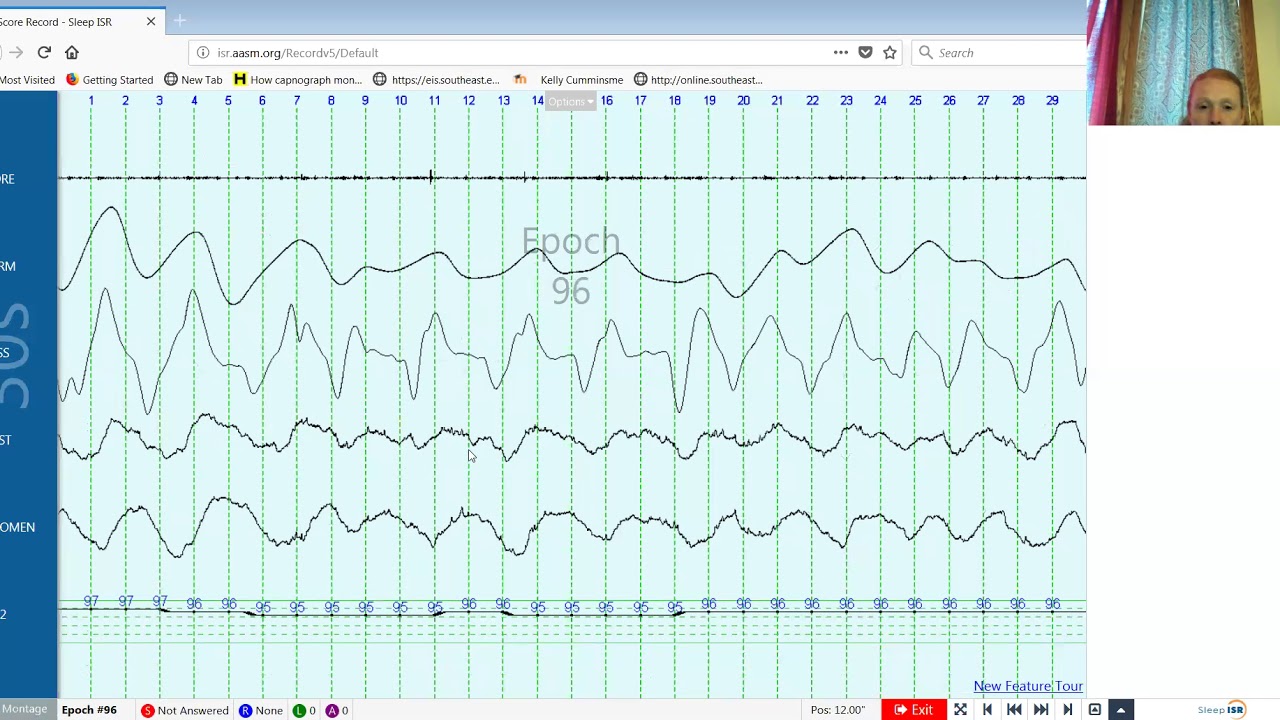 tips for respiratory scoring - YouTube