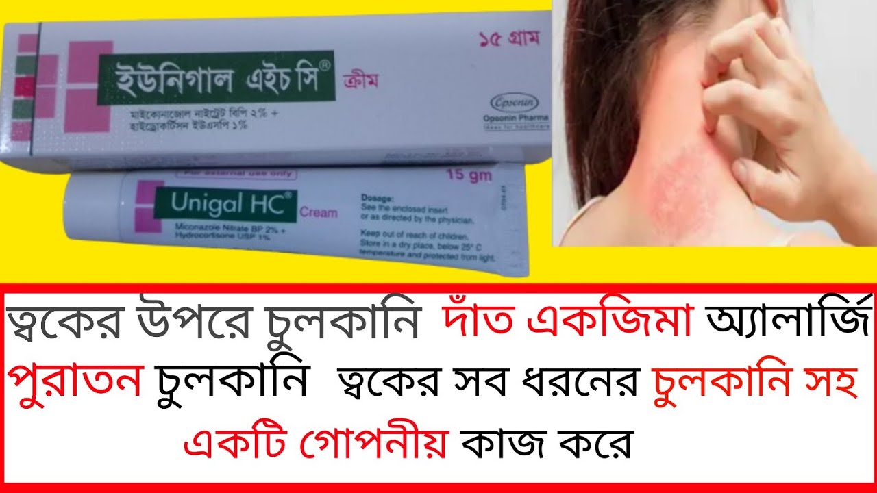 Unigal he cream এর কাজ কি | ইউনিগাল এইস সি ক্রিম |unigal he cream এর ...