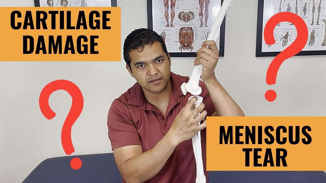 Knee Cartilage Damage VS Meniscus Tear - Which Do You Have? - YouTube