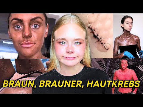 braun, brauner, Hautkrebs: Gen Z‘s Bräunungswahn
