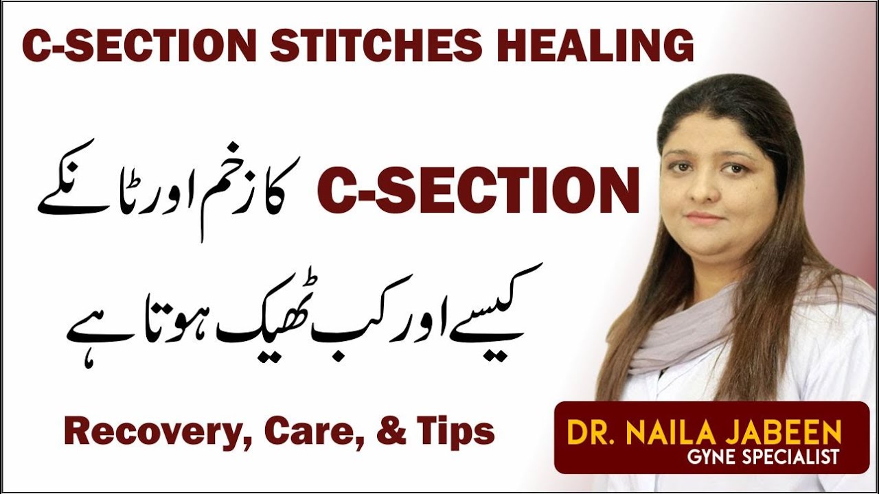 C Section Delivery Internal Stitches Wound Healing | Care Recovery ...