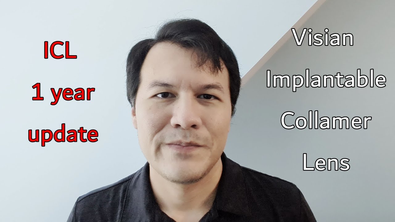 Visian EVO ICL surgery: 1 year update - YouTube