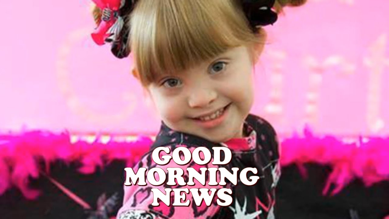 Good Morning News! This young model is Changing the Face of Beauty ...