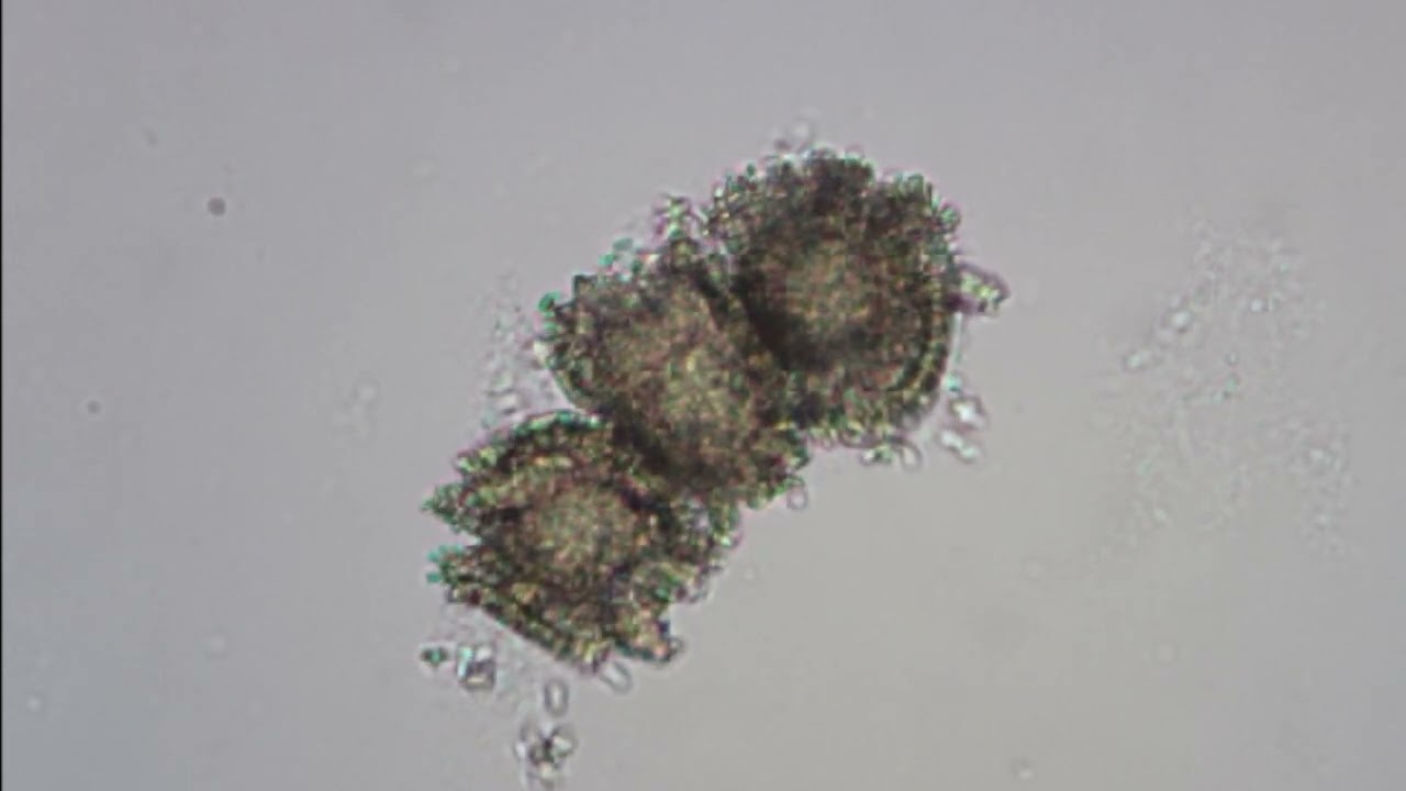 Ammonium Biurate Crystals Dog