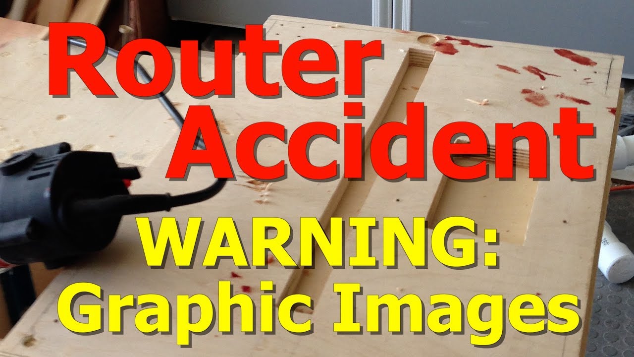 Router Accident - WARNING: Graphic Images - YouTube