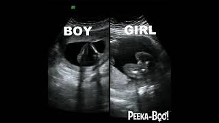 Its A Boy Ultrasound 20 Weeks