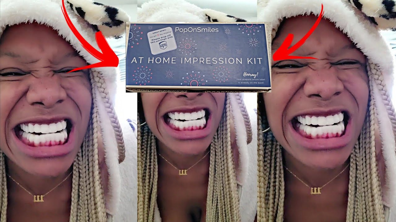 POP ON VENEERS / POP ON SMILE /HOW TO GUIDE😁 - YouTube