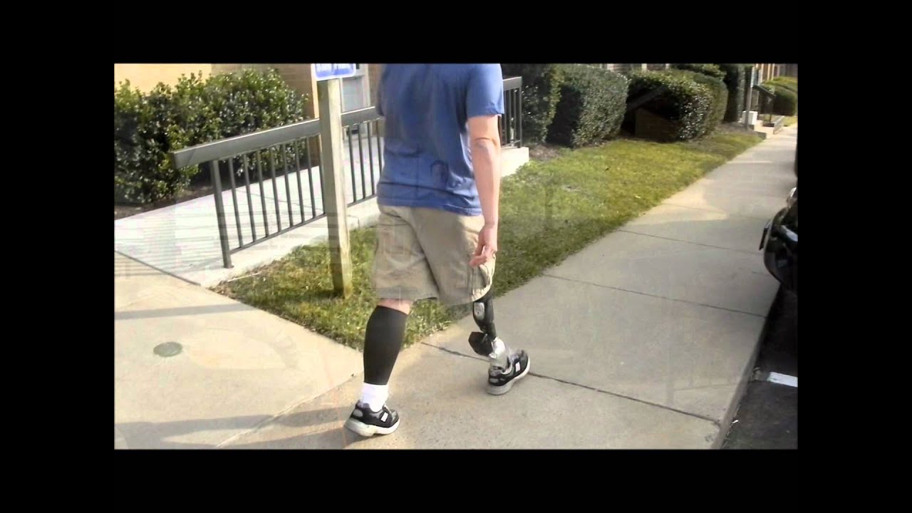 X2 + BiOM foot = Astounding results! - YouTube