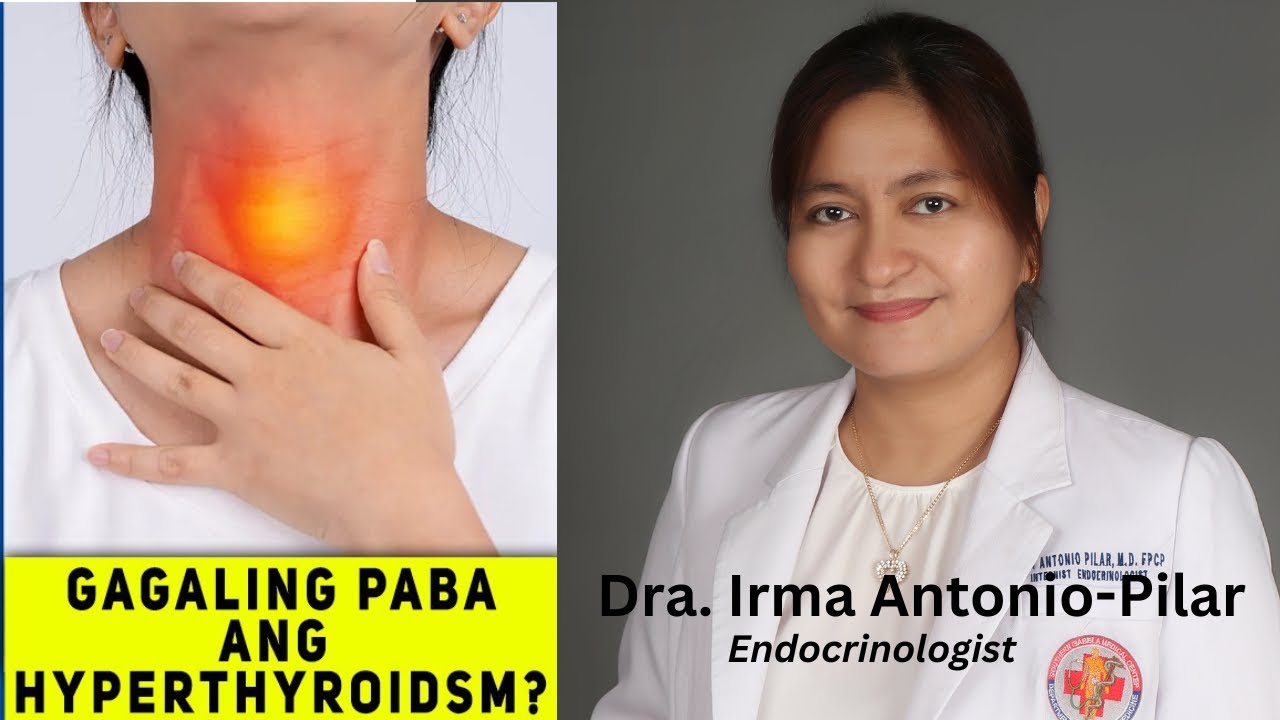 GAGALING PA BA ANG MGA PASYENTENG MAY HYPERTHYROIDISM OR TOXIC GOITER ...
