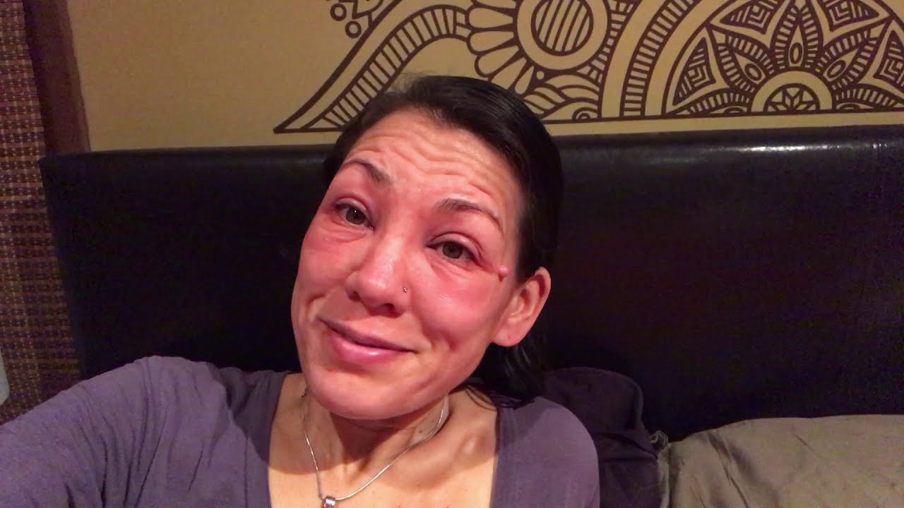 Getting Ready For Cold Sheet Treatment. - YouTube