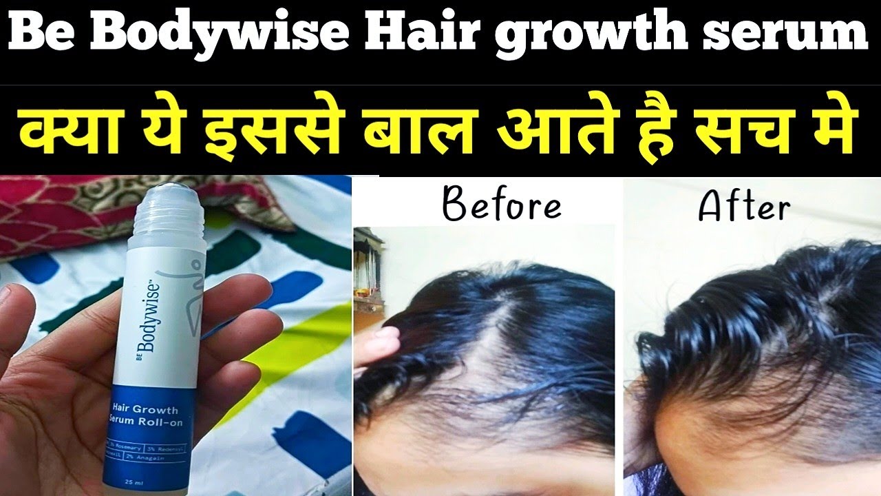 be bodywise hair growth serum review | be bodywise hair growth serum ...