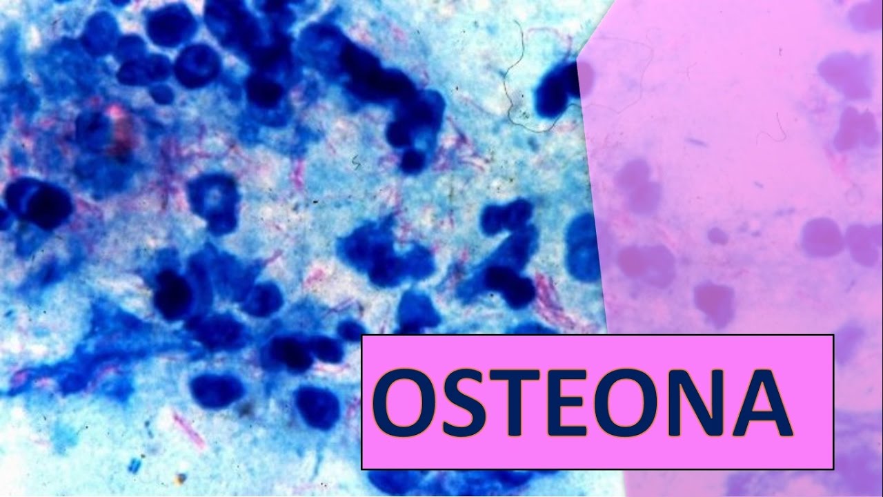 OSTEONA/ HISTOLOGIA 6 - YouTube