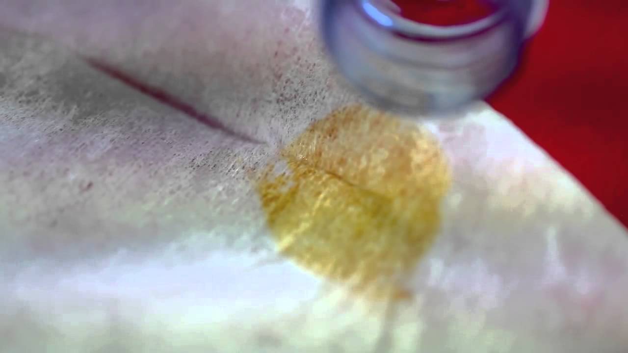 Cigarette Experiment Test Stop Smoking - Stop Smoking - Lung Cancer ...