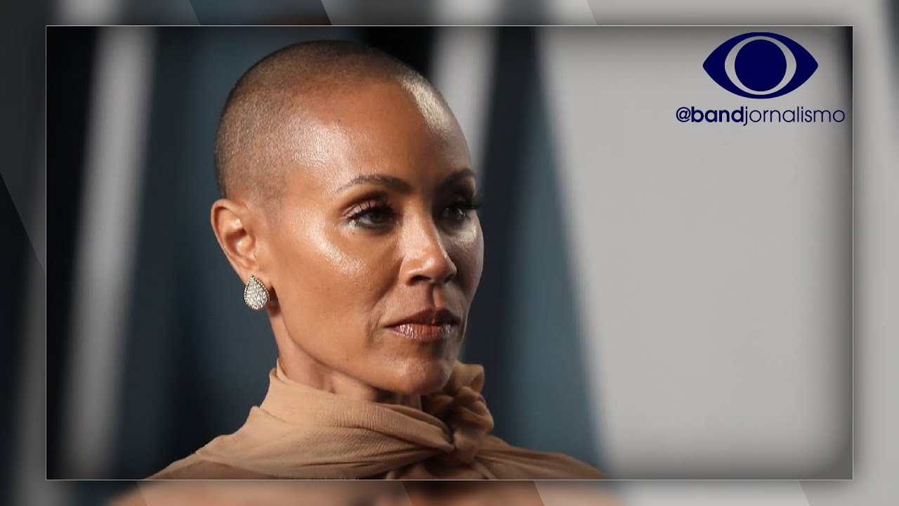 Entenda a doença de Jada Smith, a alopecia - YouTube