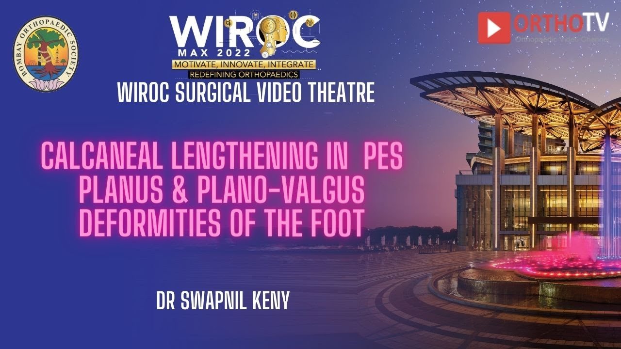 Calcaneal lengthening in Pes planus & plano-valgus deformities of the ...