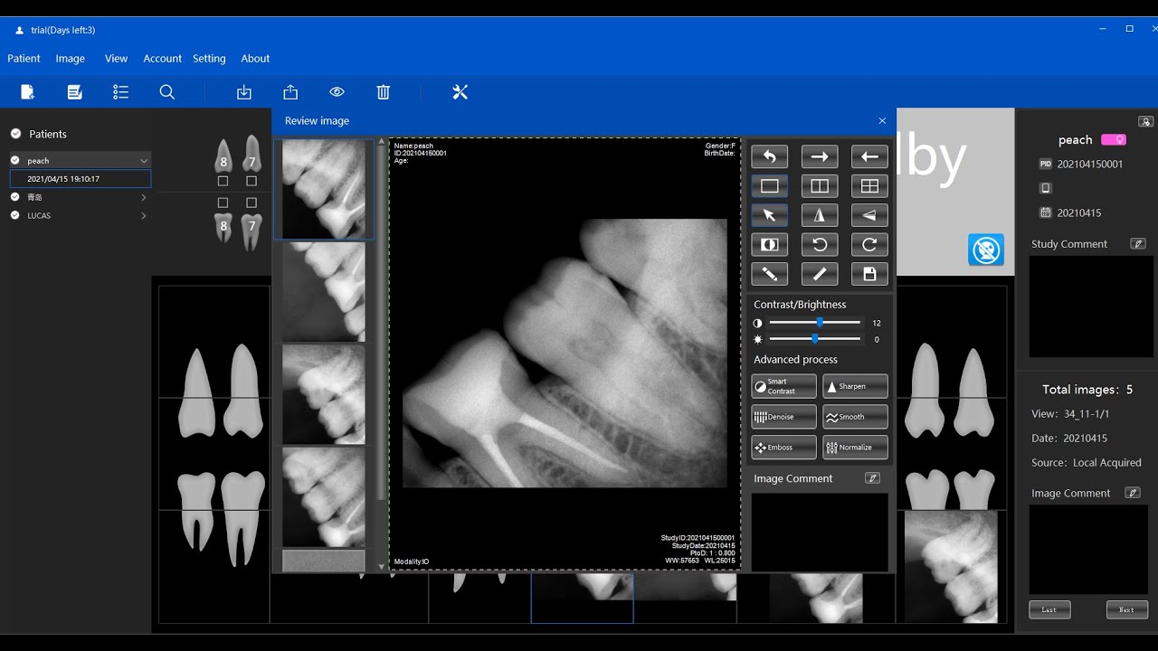How to use XlinearVision Sensor - YouTube