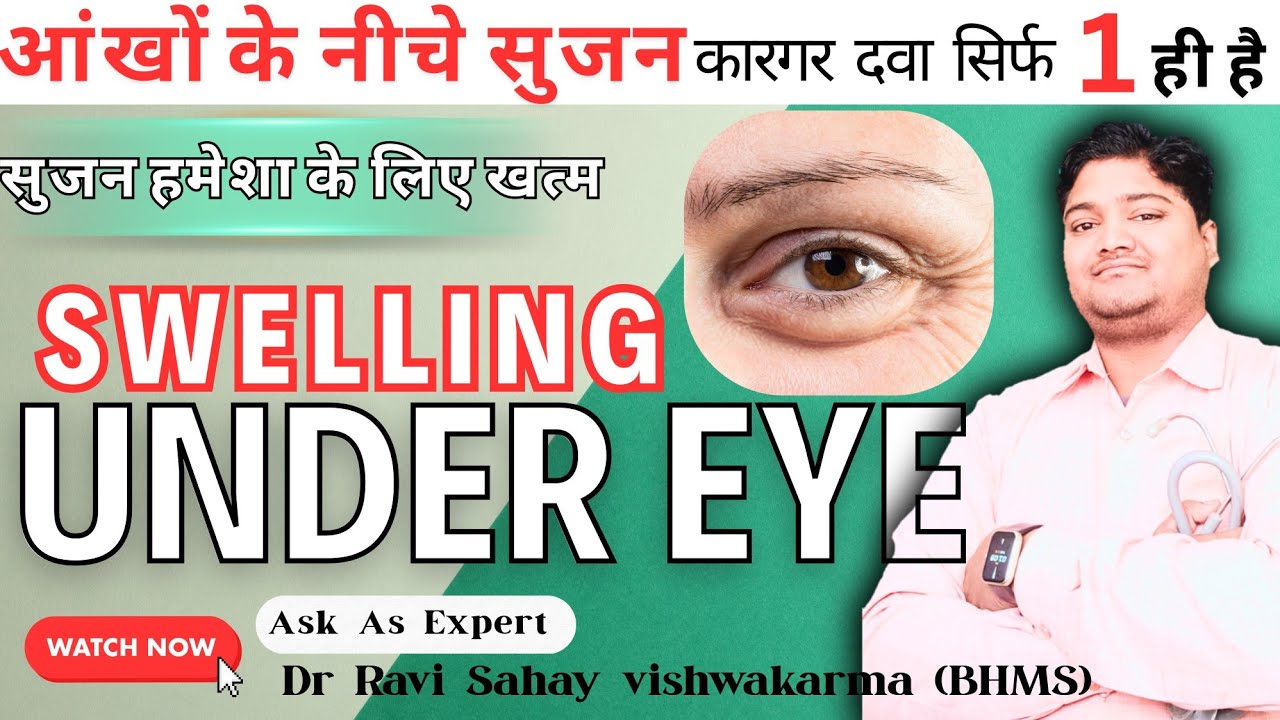 Swelling under one eye treatment | Swelling under eyes home remedy ...